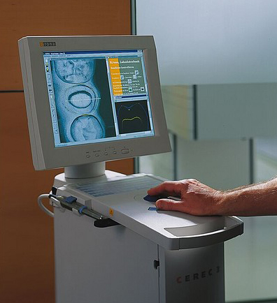 CEREC - Heather Ireland DDS